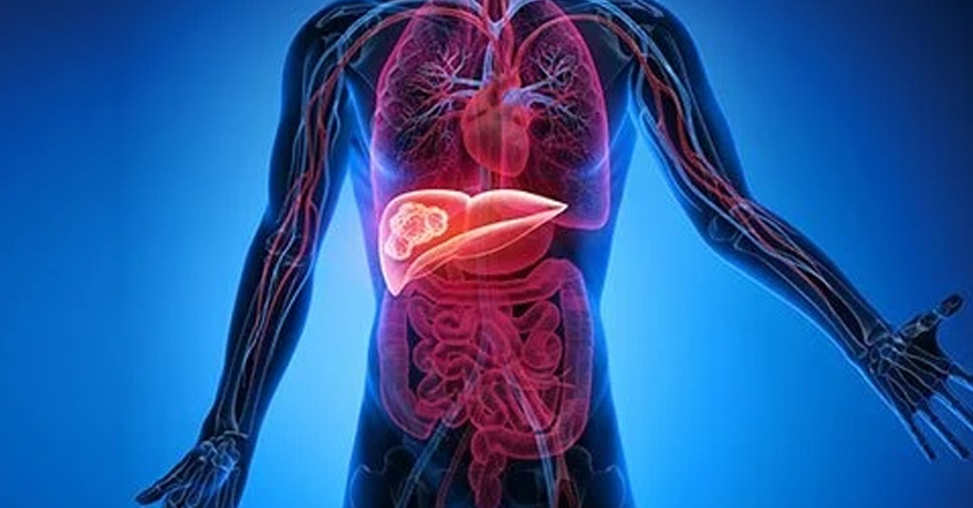 Karaciğer yağlanmasına dikkat! - ReTouch Mag